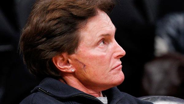 Celebrity Surgery Nightmares, flawless and forever young, Hollywood ...